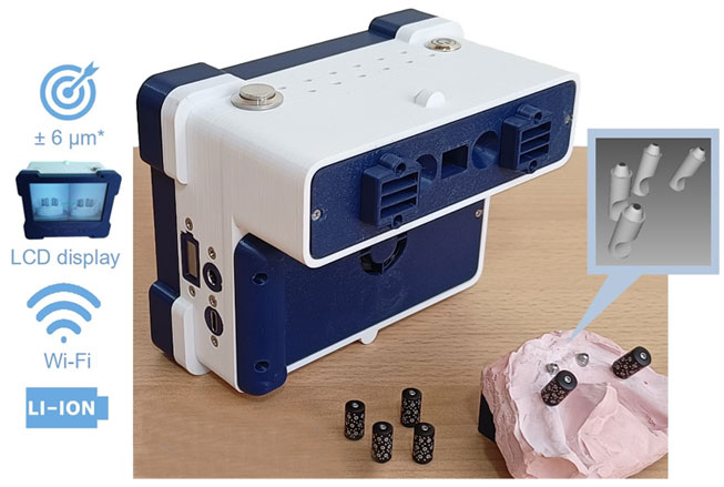 The best dental photogrammetry solution on the market